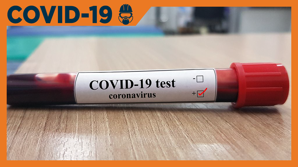 Testing, tracing could help in battle to withstand second COVID wave: Frame